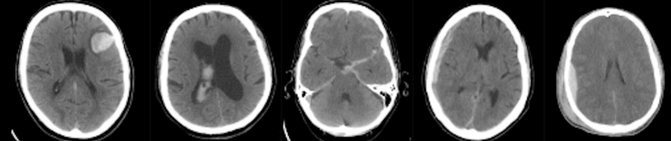 Radiology Datasets for AI Model Training | Aslan, MD
