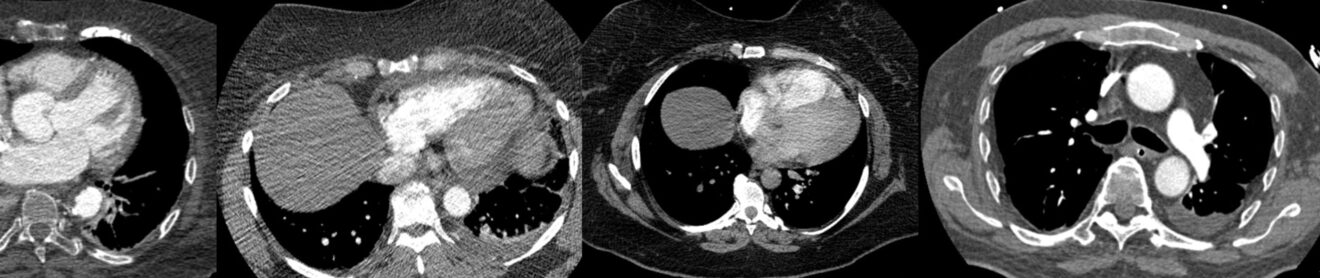 Radiology Datasets for AI Model Training | Aslan, MD
