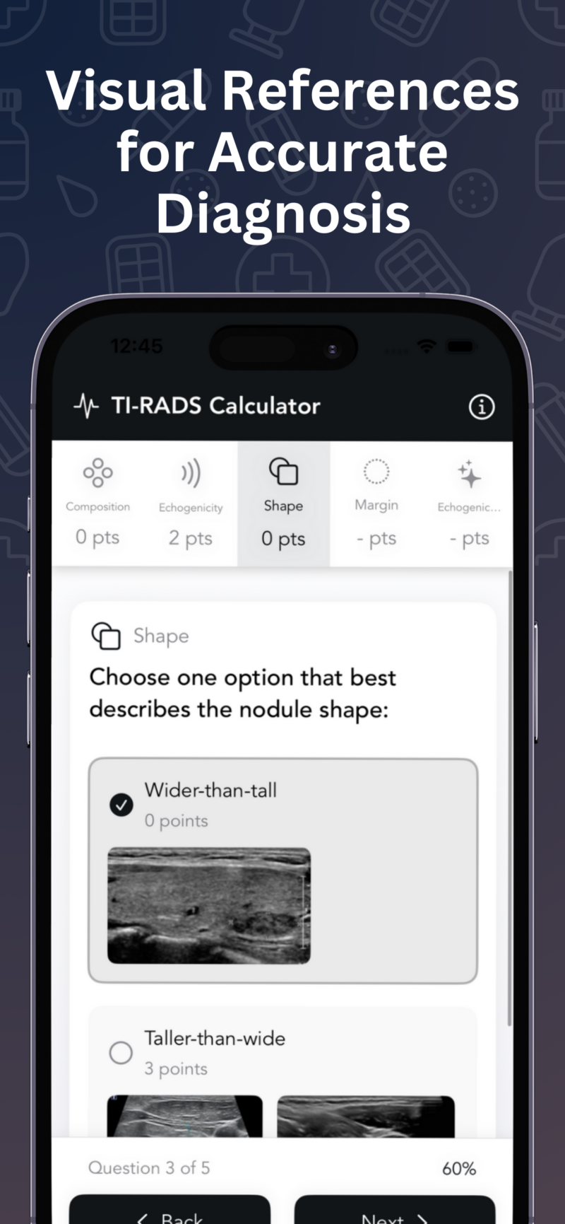 How to Calculate TI-RADS Score Easily? | Aslan, MD