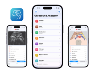 Ultrasound Anatomy Atlas - Images with Interactive Visuals | Aslan, MD